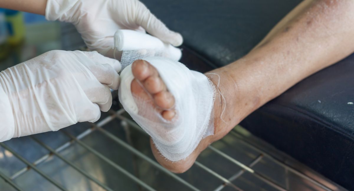 MLS Laser Therapy for Diabetic Foot Wounds